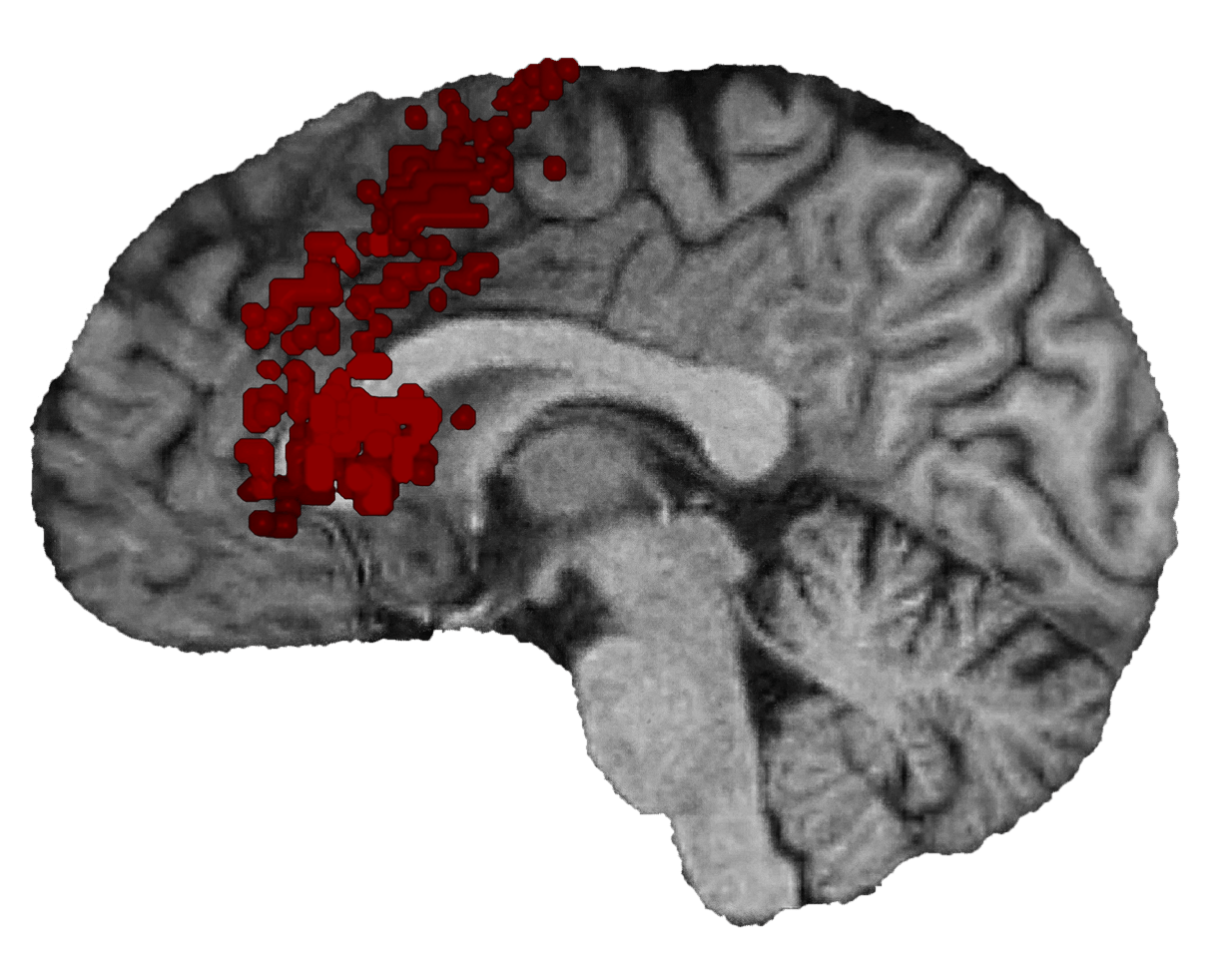 The Salience Network