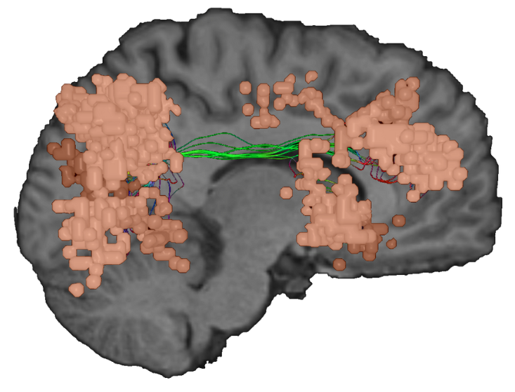 The Ventral Attention Network