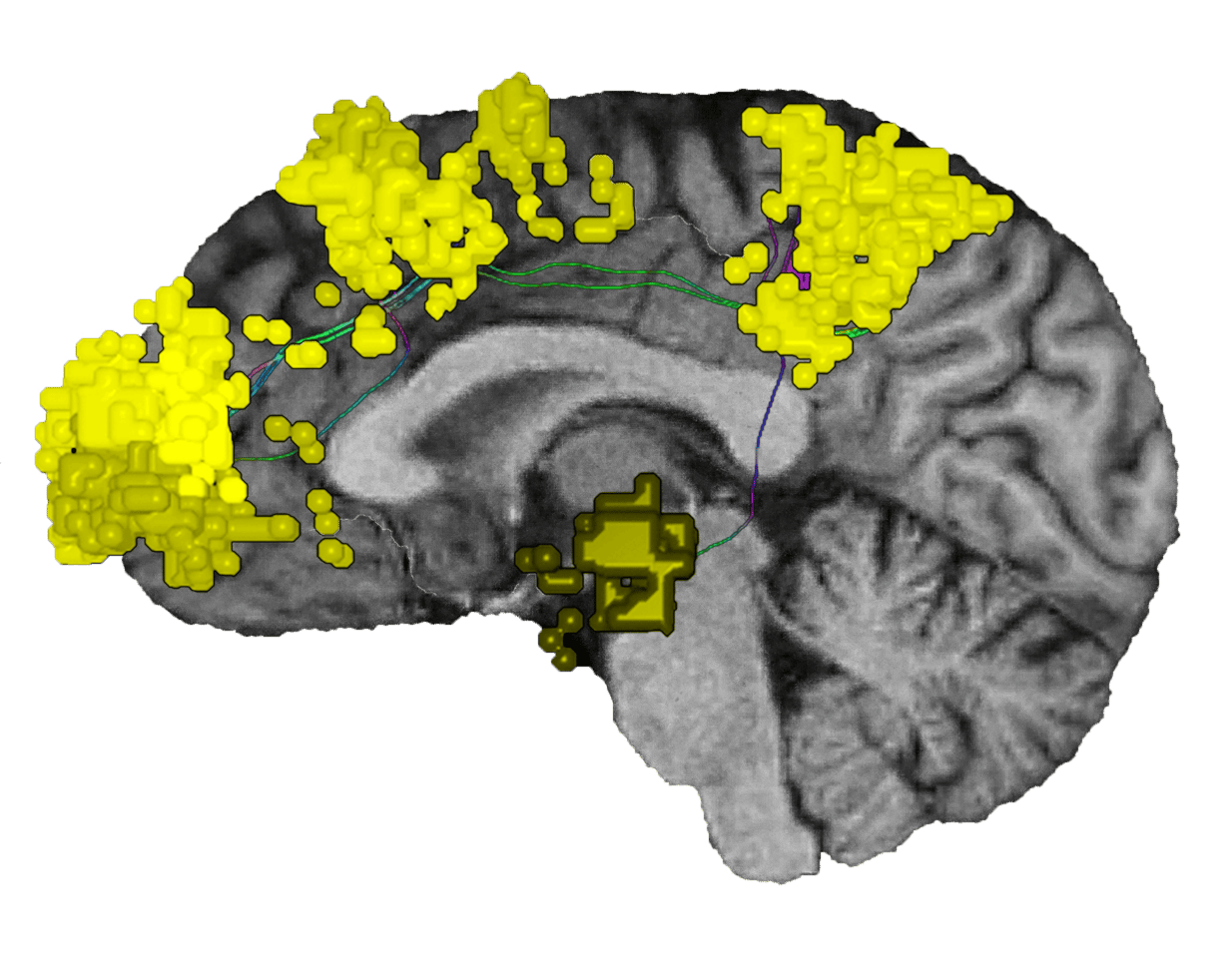 The Central Executive Network