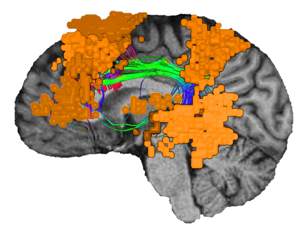 What is connectomics?