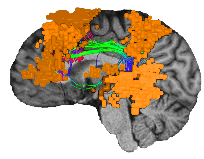 What is connectomics?