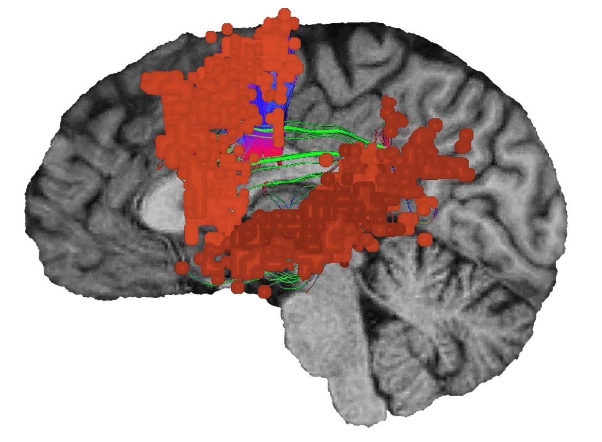 The auditory system