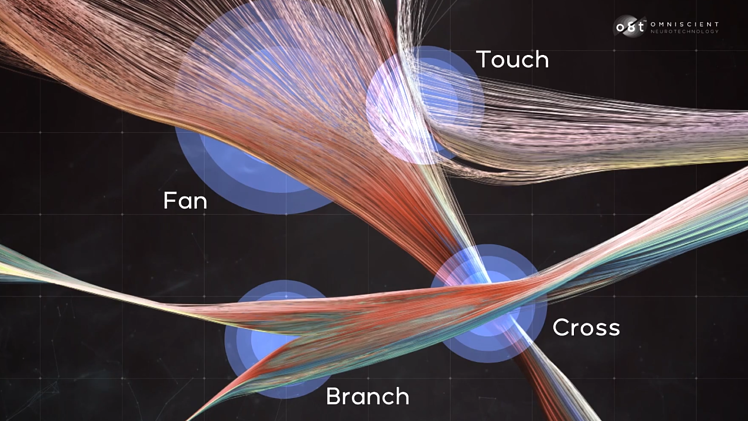 What is tractography?