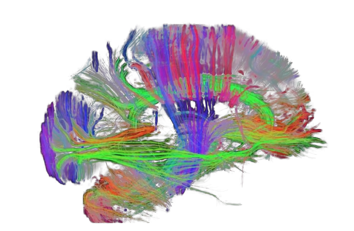What are brain networks?