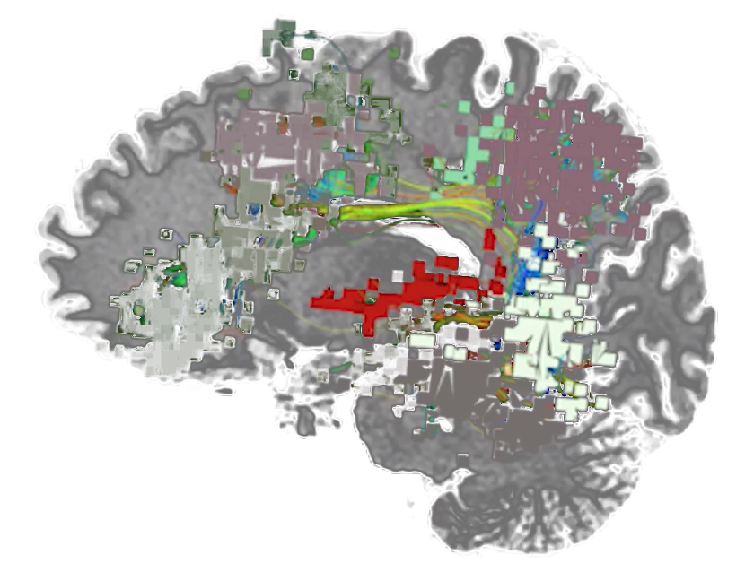 What are brain networks?