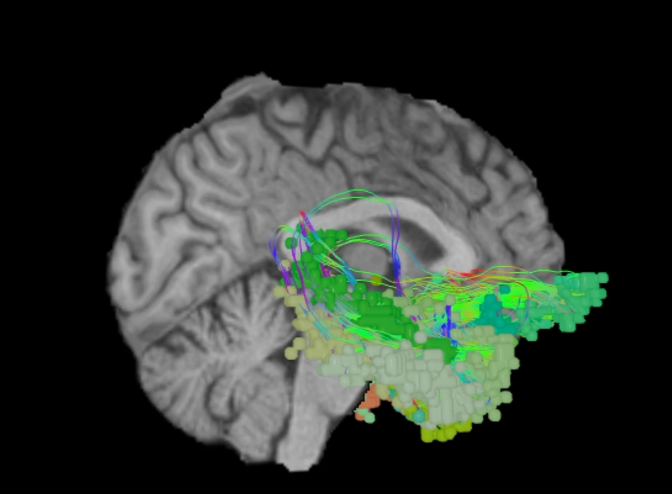 The trouble with calling brain regions ‘eloquent’