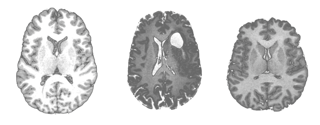 What is connectomics?
