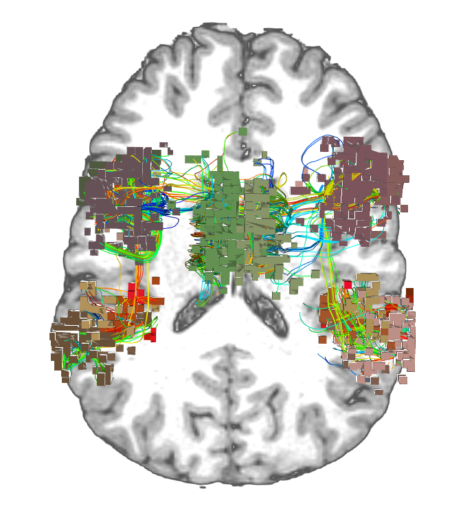 What are brain networks?