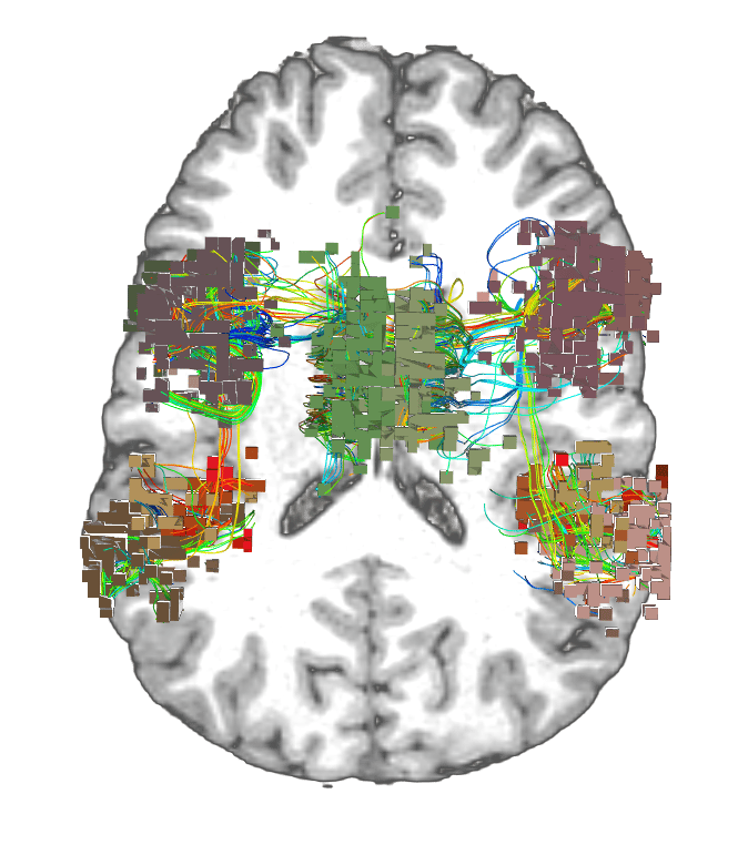 What are brain networks?