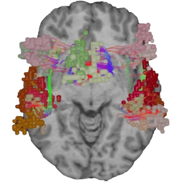 The auditory system