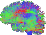 What are brain maps?