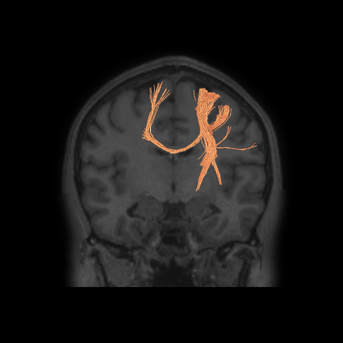 Dorsal Attention Network - Connectome Guide