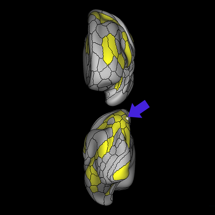 Dorsal Attention Network - Connectome Guide