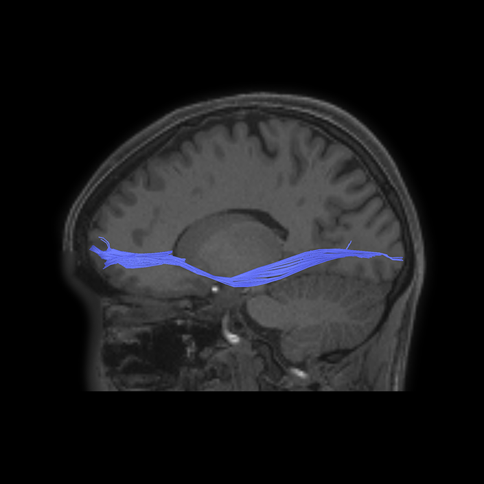 Limbic/Paralimbic System - Connectome Guide