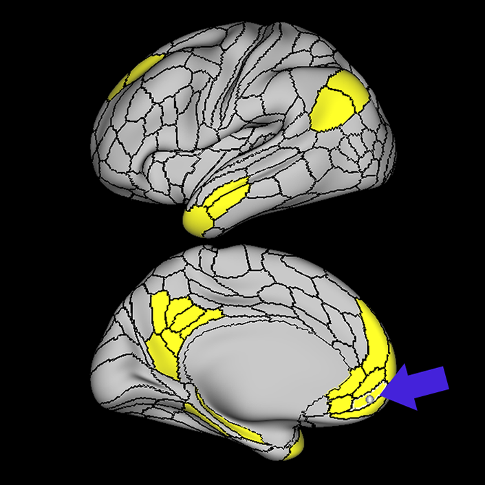 Default Mode Network - Connectome Guide