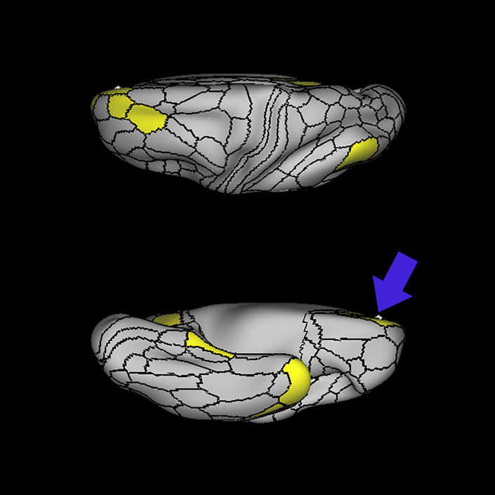 Default Mode Network - Connectome Guide