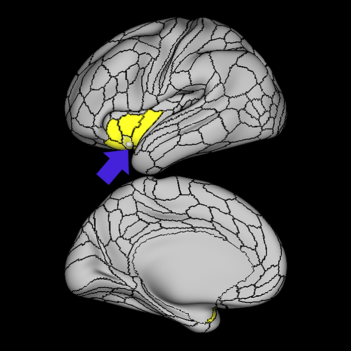 Limbic/Paralimbic System - Connectome Guide