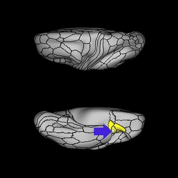Limbic/Paralimbic System - Connectome Guide