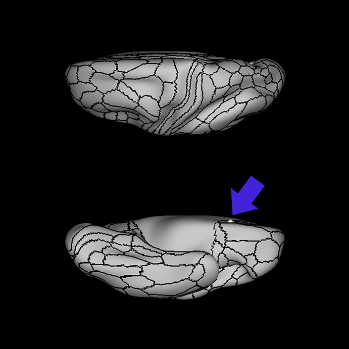 Limbic/Paralimbic System - Connectome Guide