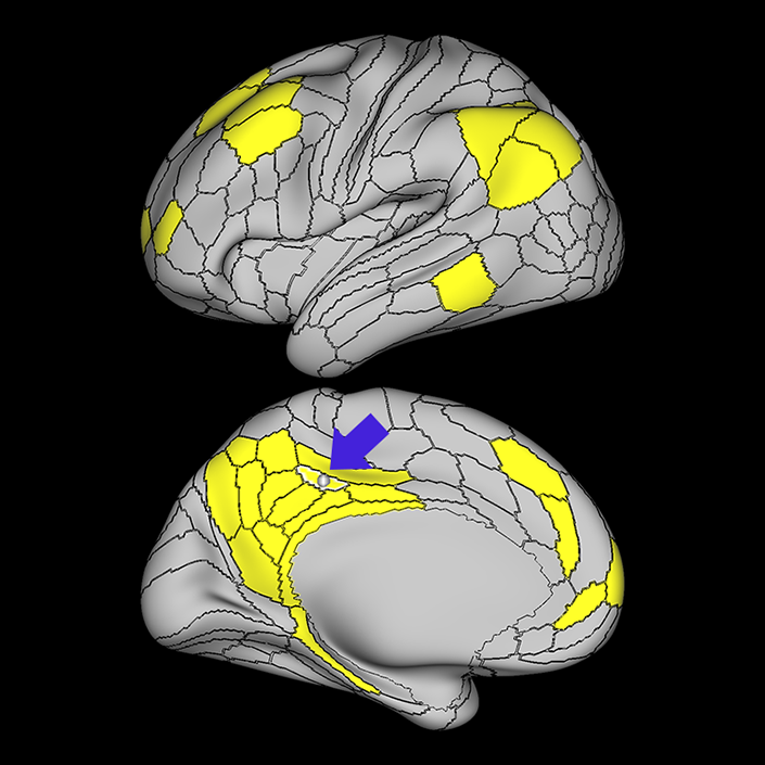 Default Mode Network - Connectome Guide