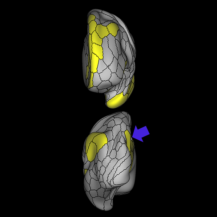 Default Mode Network - Connectome Guide