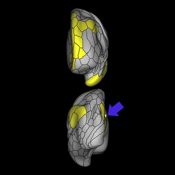 Default Mode Network - Connectome Guide