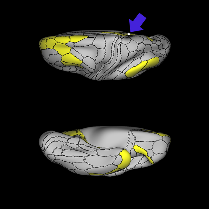 Default Mode Network - Connectome Guide