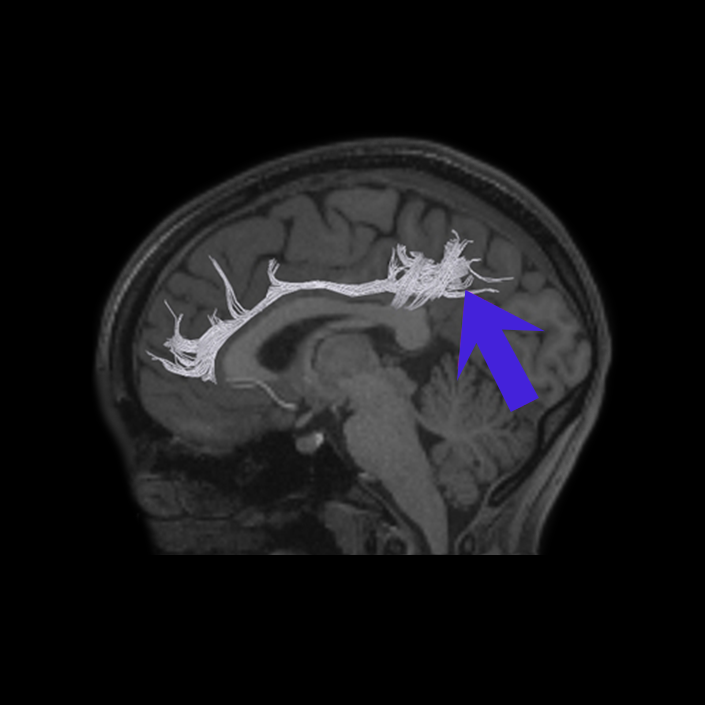 Default Mode Network - Connectome Guide