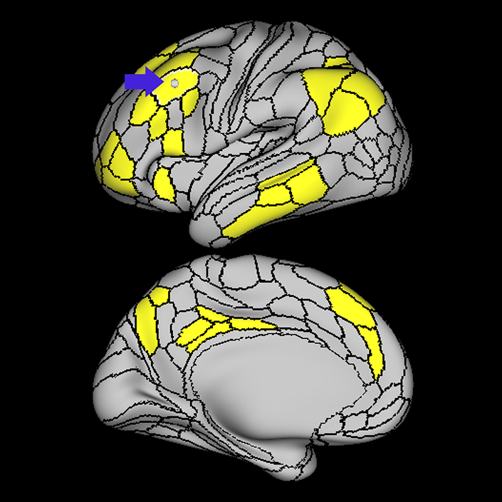 Auditory Network - Connectome Guide