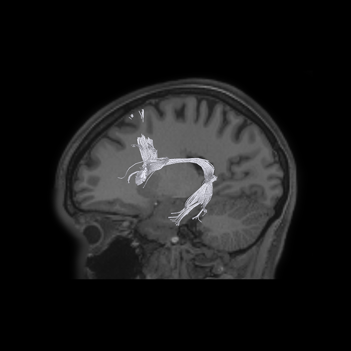 Auditory Network - Connectome Guide