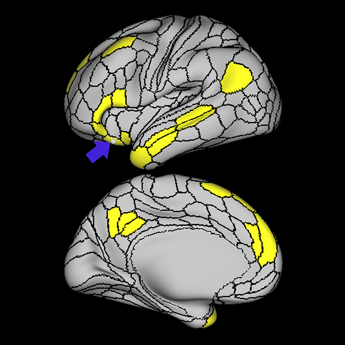Limbic/Paralimbic System - Connectome Guide