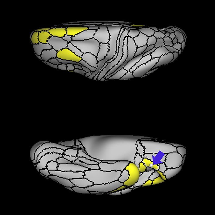 Limbic/Paralimbic System - Connectome Guide