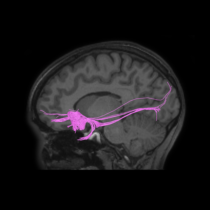 Limbic/Paralimbic System - Connectome Guide