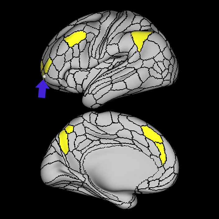Central Executive Network - Connectome Guide