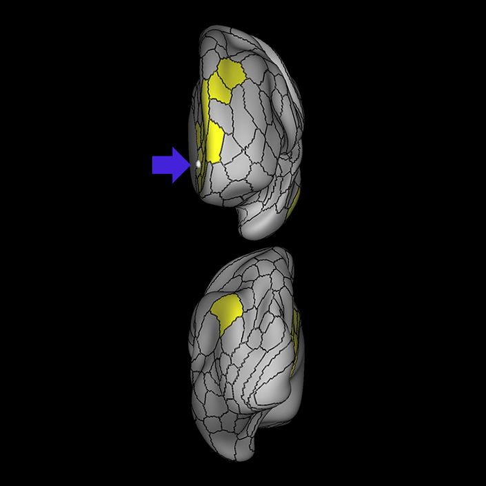 Default Mode Network - Connectome Guide
