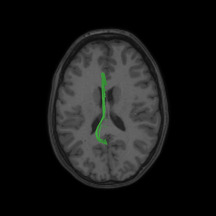 Default Mode Network Connectome Guide