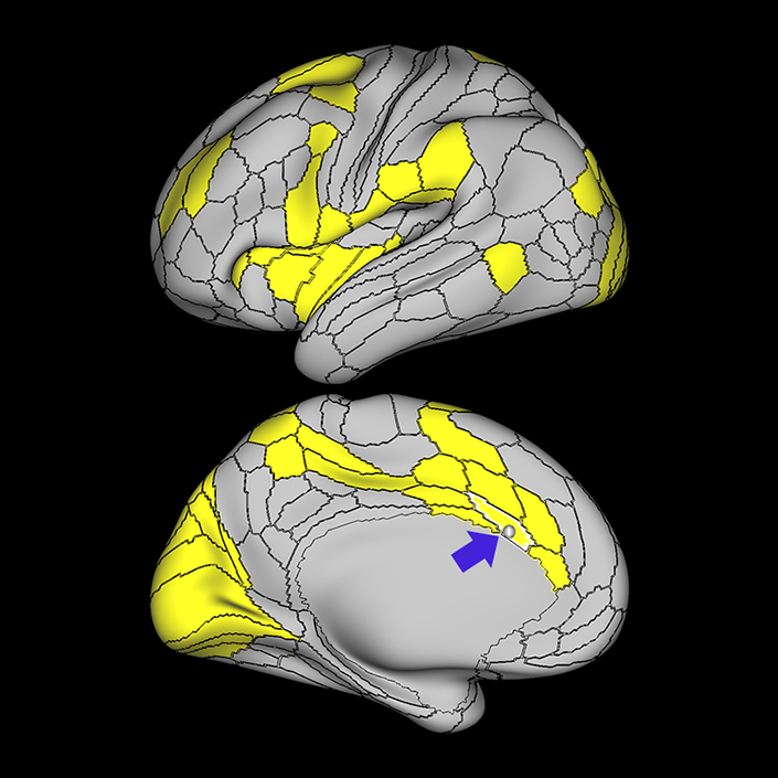 Salience Network - Connectome Guide