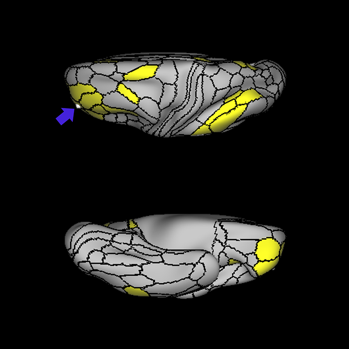 Multiple Demand Network - Connectome Guide