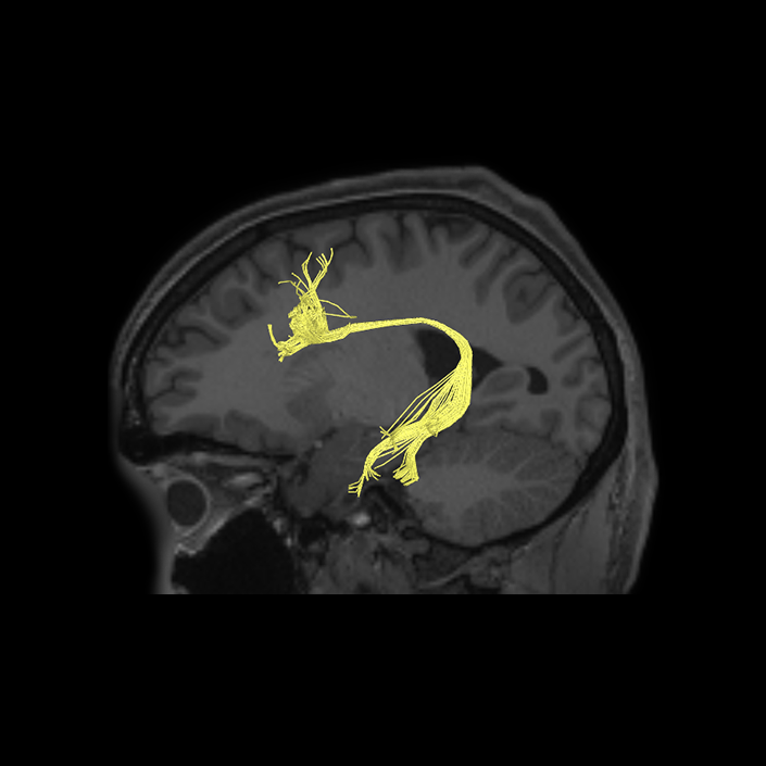 Language System - Connectome Guide