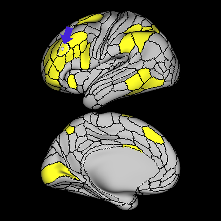 Multiple Demand Network - Connectome Guide