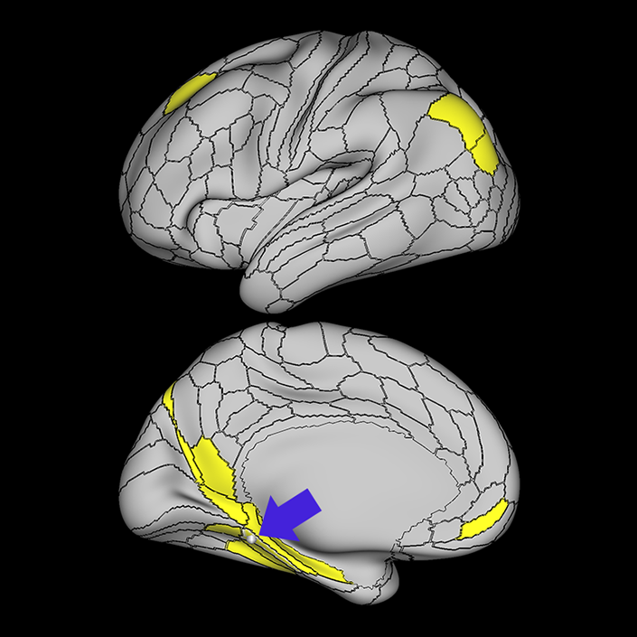 Medial Temporal Network - Connectome Guide