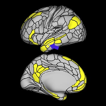 Accessory Language Network - Connectome Guide