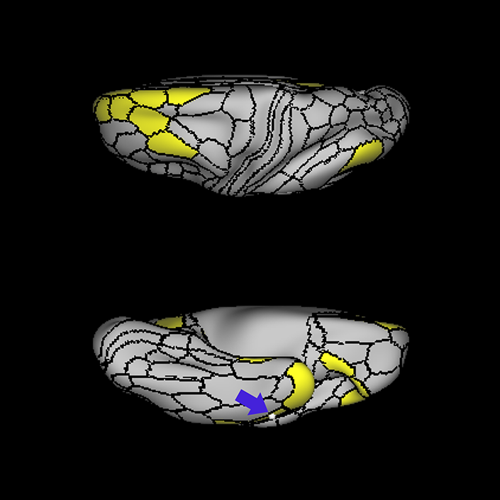 Accessory Language Network - Connectome Guide