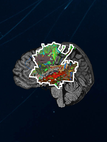 Auditory Network - Connectome Guide