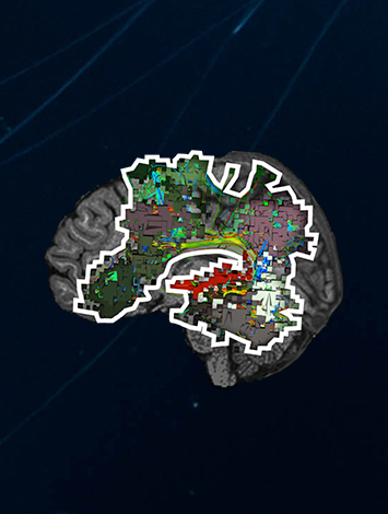 Language System - Connectome Guide