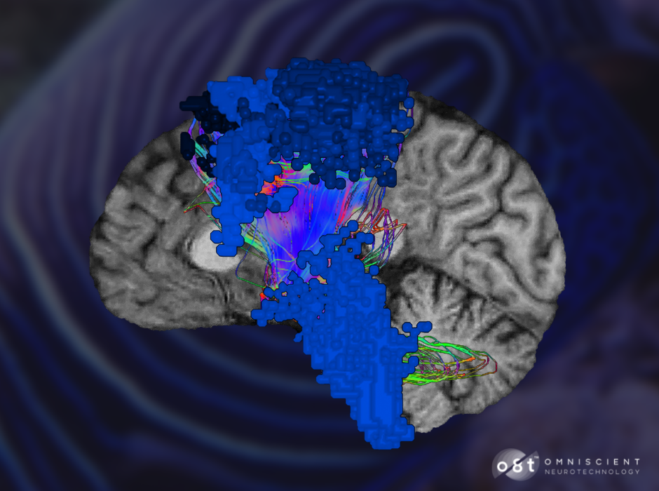 The Sensorimotor Network